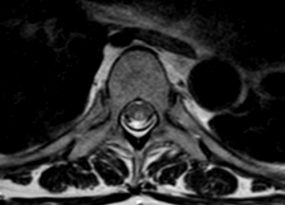 Spotters-01 – Meenakshi Radiology