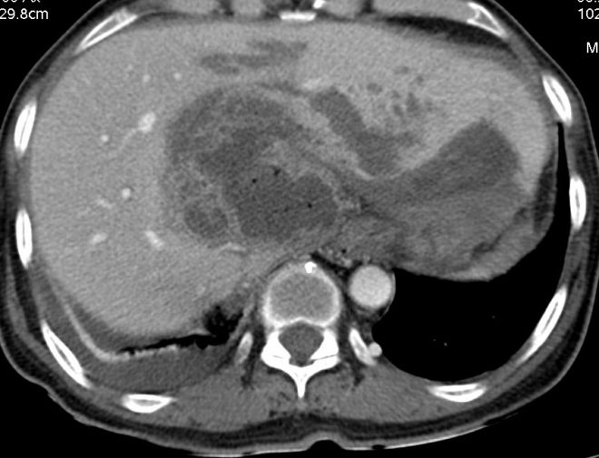 Spotters-123 – Meenakshi Radiology